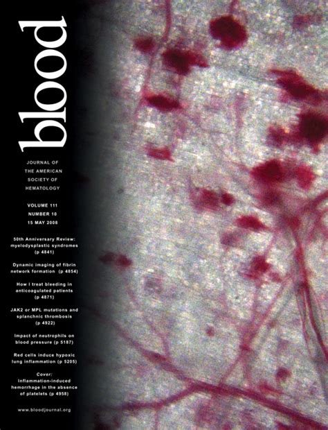 Hemojuvelin Regulates Hepcidin Expression Via A Selective Subset Of Bmp