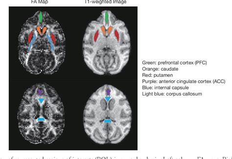 Figure 1 From Evaluation Of Multi Shell Diffusion Mri Acquisition