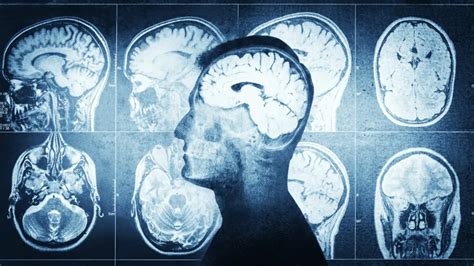 Learn The Language Of Your Mind Using Neuro Linguistic Programming