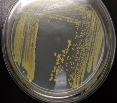 Yellow Pigmented Bacteria On Zobells Marine Agar Media Download