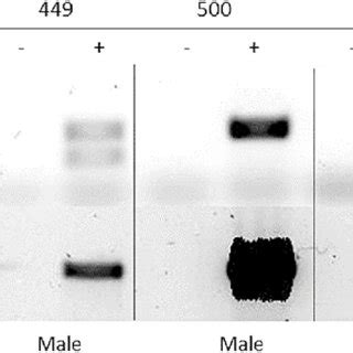 Confirmation Of Sex In Selected Individual Samples Using X Linked G6PD Download Scientific