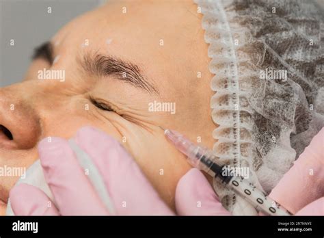Contour Plastic A Cosmetologist Injects A Botulinum Toxin To Tighten