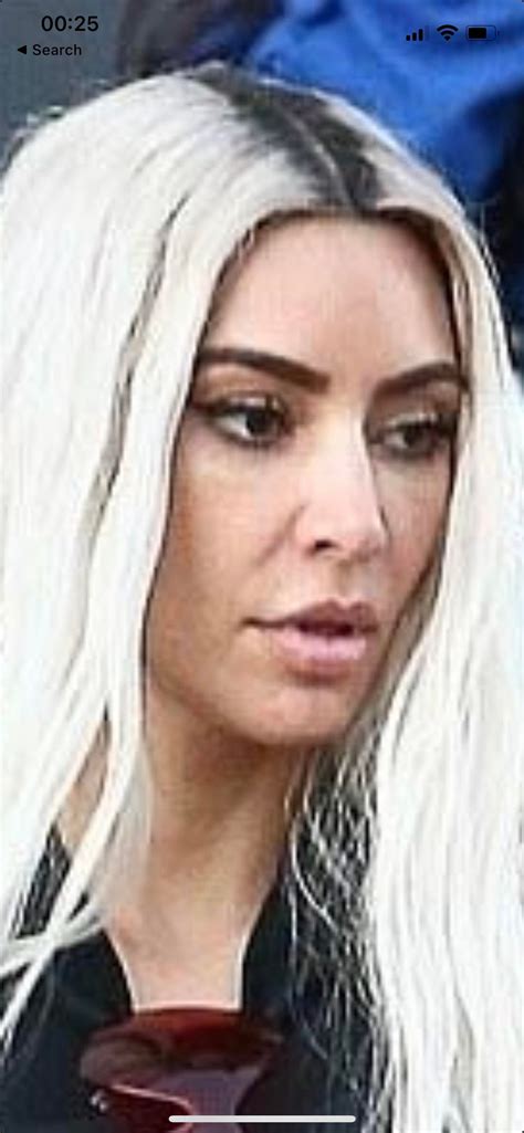 Kimmy Needs To Step Away From The Surgeons Office Rkuwtksnark