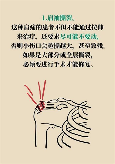 肩膀疼的原因很多抻一抻会缓解 生活养生频道 东方养生