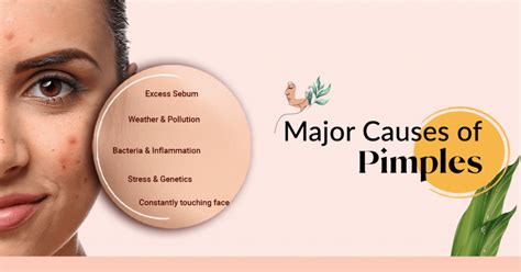 4 Easy Ways To Get Rid Of Pimples At Home Overnight Excelebiz