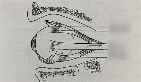 Extrinsic Eye Muscles Diagram Quizlet