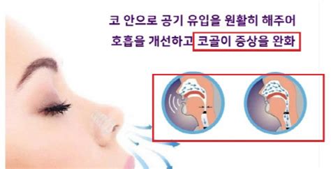 식약처 의료기기 오인 광고 기획점검 결과 발표 국민의 안전을 위한 세이프코리아뉴스