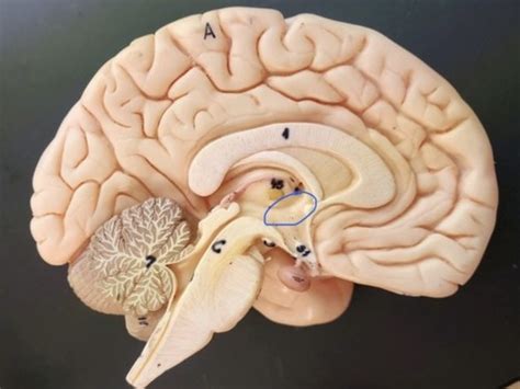 Diencephalon Brain Model Flashcards Quizlet