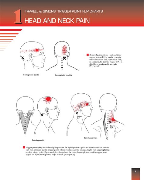 Splenius Capitis Trigger Points