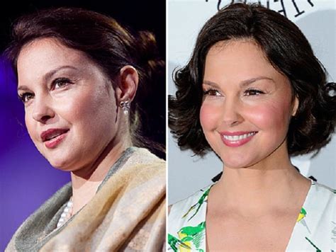 Ashley Judd Before And After Plastic Surgery