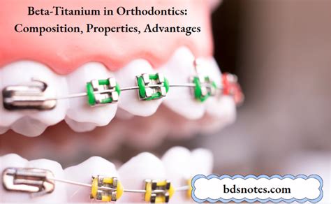 Beta Titanium In Orthodontics Composition Properties Advantages Beta Titanium In Orthodontics Composition Properties Advantages