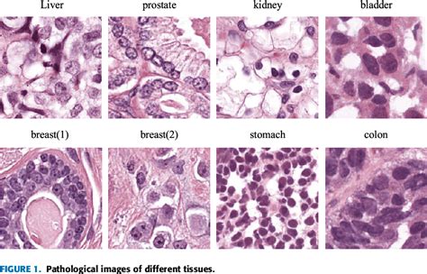Figure 1 From An Accurate Nuclei Segmentation Algorithm In Pathological