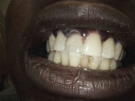 Dr Mitzi Ezzat Dental Office Dentist And Dental Office Winnipeg