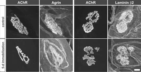 Synaptic Basal Lamina Components Remain Localized To Nmjs After Download Scientific Diagram
