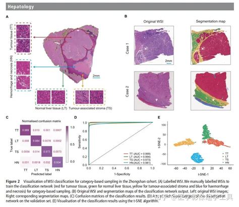 病理组学生存分析 数据委托实验基于深度学习探索肝细胞癌病理图像中的预后指标 知乎