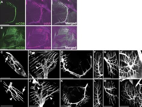 The Sex Determination Genes Fruitless And Doublesex Specify A Neural