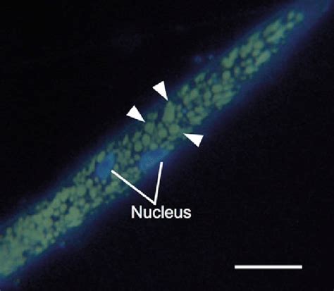 2 Polyphosphate Status In The Vacuoles Of Gigaspora Margarita Germ Download Scientific Diagram