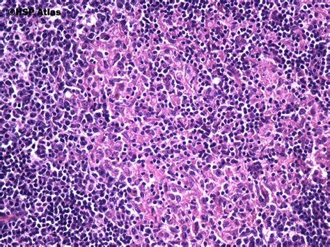 Hsp Atlas Histopathology Atlas