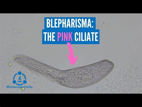 Blepharisma