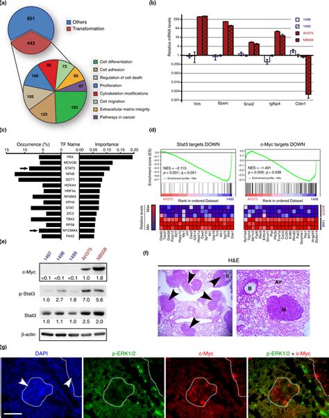 Stemness Gene Expression Pattern In Pancreatic Ductal Adenocarcinoma