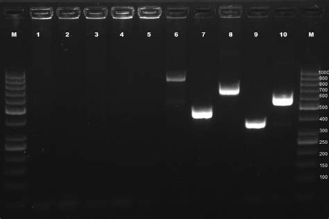 Multiplex Pcr Assay For Carbapenemase Encoding Genes Multiplex Pcr Download Scientific Diagram