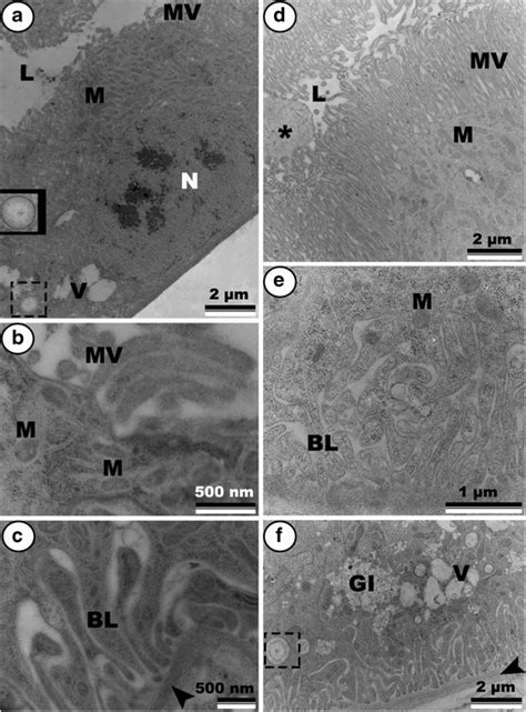 Micrographs Of Electron Dense Cells Dc And Electron Lucent Cells Lc