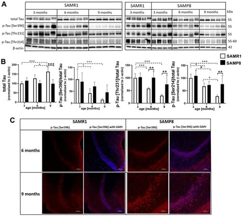 Hyperphosphorylation Of Tau Protein In The Hippocampi Of Samp8 Mice A Download Scientific