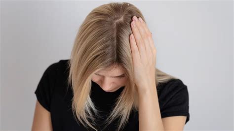 5 Natural Ways To Cleanse Your Scalp And Prevent Haircare Woes