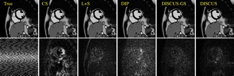 Figure 3 From Deep Image Prior With Structured Sparsity Discus For Dynamic Mri Reconstruction