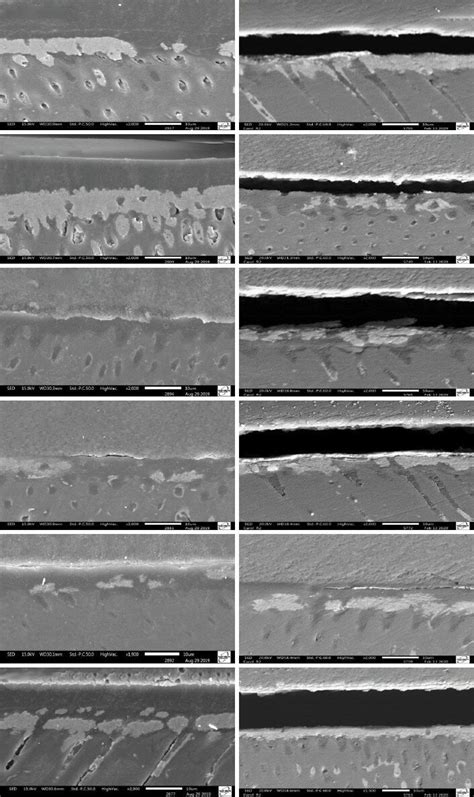 Representative Sem Micrographs Of Silver Nitrate Impregnation