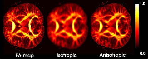 Left Fa Image Middle Isotropic Gaussian Kernel Smoothing With 12mm Download Scientific