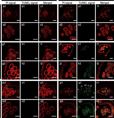 Detection Of Dna Fragmentation By The Tunel Assay Green Fluorescence Download Scientific