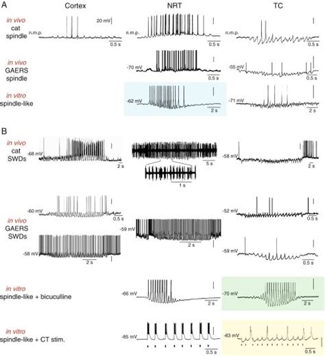 Intracellular Membrane Potential Correlates Of Cortical Tc And Nrt