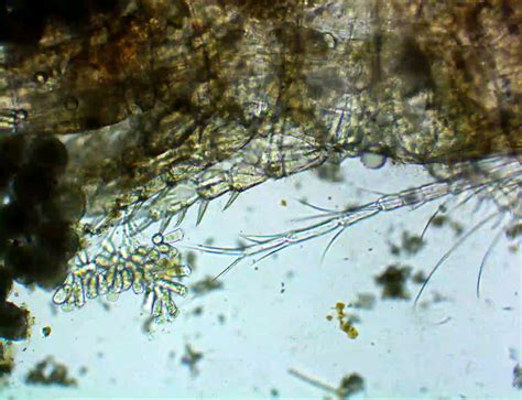 Video 2 Of Stalked Cilliates Rmicrobiology