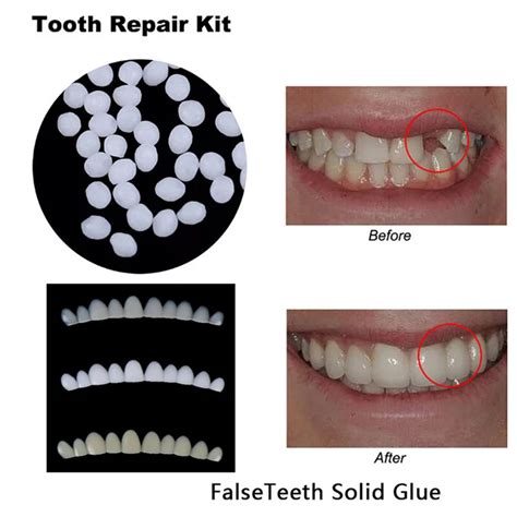 Temporary Tooth Repair Kit Teeth Gaps Falseteeth Solid Glue Denture