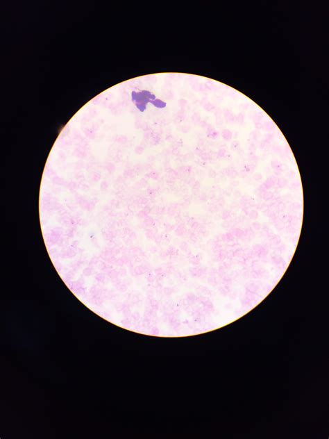 Malaria Data Object Detection Model By Malaria Data