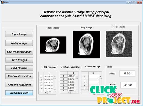 sar image denoising via clustering based principal component analysis