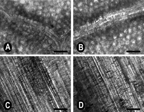 Calcium Oxalate The Stinging Crystals In Plants