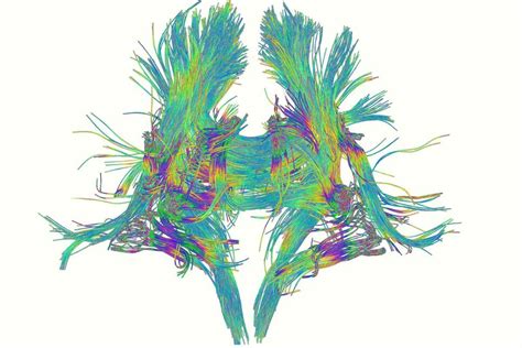 Understanding Sex Differences In Concussion Female Vulnerability In Concussions — Concussion