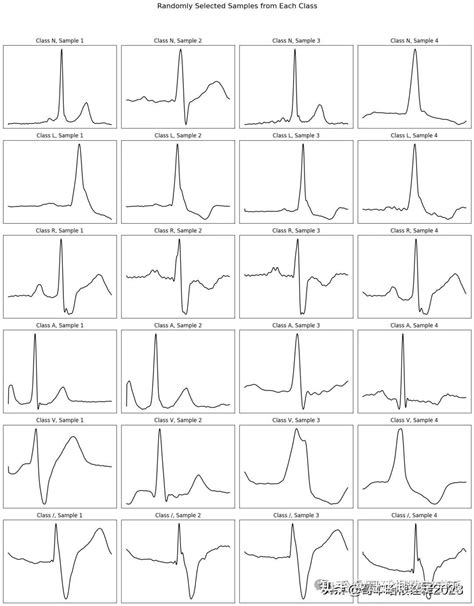 简单的基于transformer的滚动轴承故障诊断（nasa Ims轴承数据集，python） 知乎