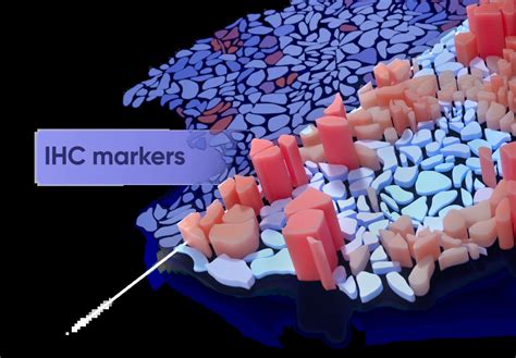 Immunohistochemistry Ihc Test Bostongene