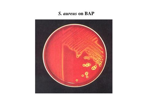 Ppt Pyogenic Coccus Powerpoint Presentation Free Download Id 3589406