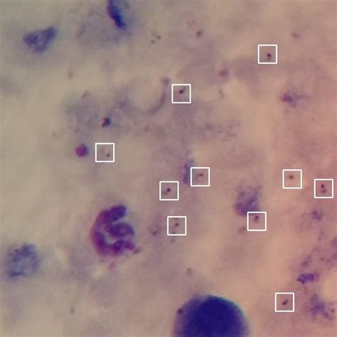 Sample Microscopic Images Containing Ground Truth Bounding Boxes For Download Scientific