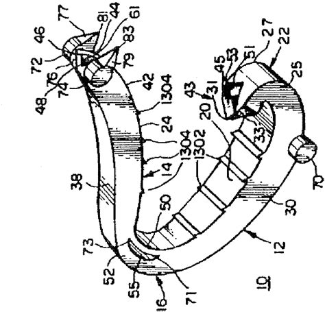 Anti Migration Surgical Ligation Clip Eureka Patsnap