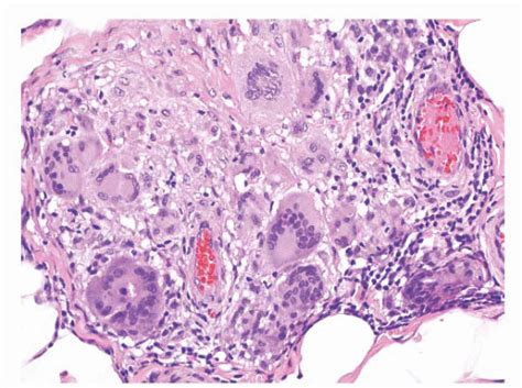 Spermatic Cord Histology Pathology Outlines