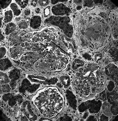 Electron Microscopy Services Jason Reidy Glomerulus