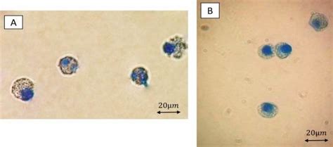 Tryptase Ihc In The Mast Cell Cytoplasm Was Identified By Brown Colour Download Scientific