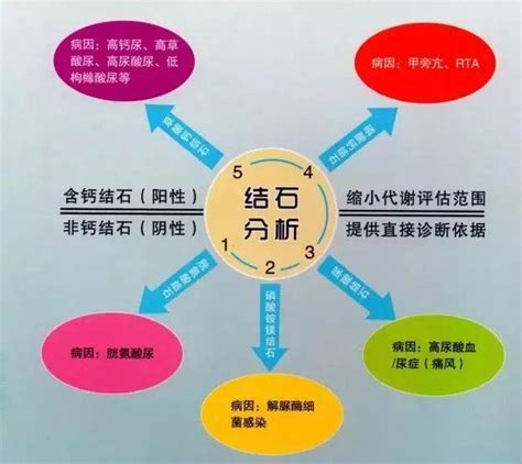 泌尿系结石代谢评估与复发预防中国专家共识2023 知乎