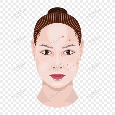 여드름 배경 Png 일러스트 및 벡터 이미지 무료 다운로드 Lovepik