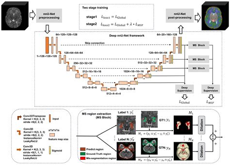 Bioengineering Free Full Text A Novel Mis Seg Focus Loss Function Based On A Two Stage Nnu